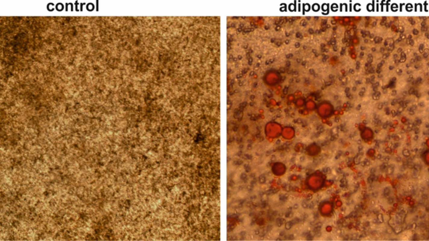 Osteogenic And Adipogenic Differentiation Of Human Mesenchymal Stem
